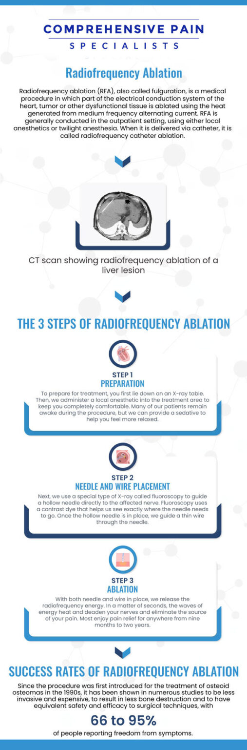 Radiofrequency Ablation Near Me in Wilkes-Barre, PA